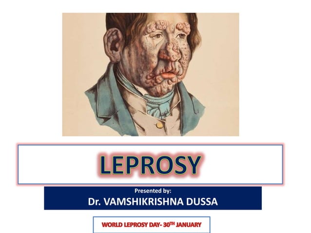 Leprosy | PPSX | Infectious Diseases | Diseases and Conditions