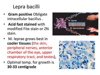 Leprosy . Dr. Abhinav Golla , Associate Professor , Lab Director ...