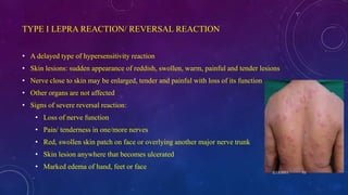Leprosy | PPTX