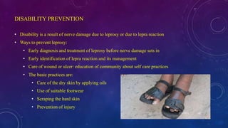 Leprosy | PPTX
