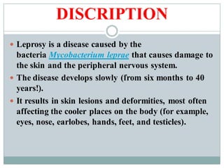 Leprosy | PDF