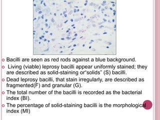 Diagnosis of Leprosy | PPTX