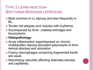 Diagnosis of Leprosy | PPTX