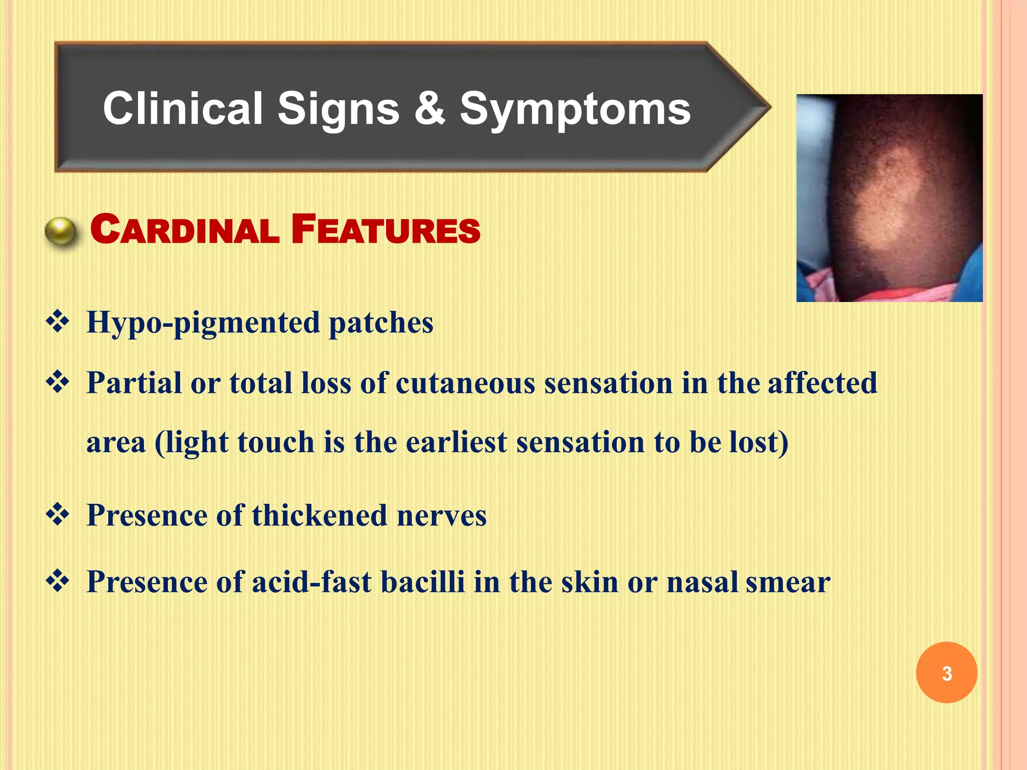 Leprosy.ppt