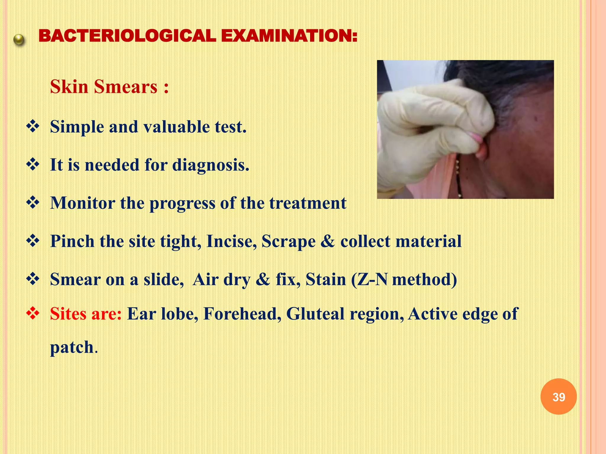 Leprosy.ppt