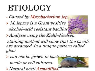 Leprosy_٢.pptx