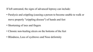 LEPROSY.ppt