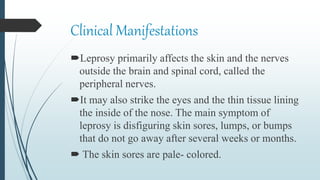 Leprosy.pptx