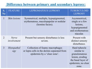 leprosy, pharmacologynotes, types,clinicalfeatures | PPTX