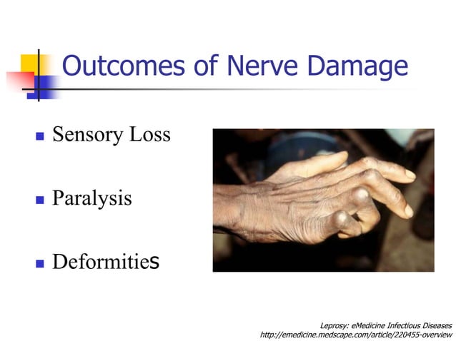 Leprosy and its cause and effect.Also nursing interventions and sign ...