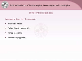 LEPROSY dermatology microbiology - hansen | PPTX