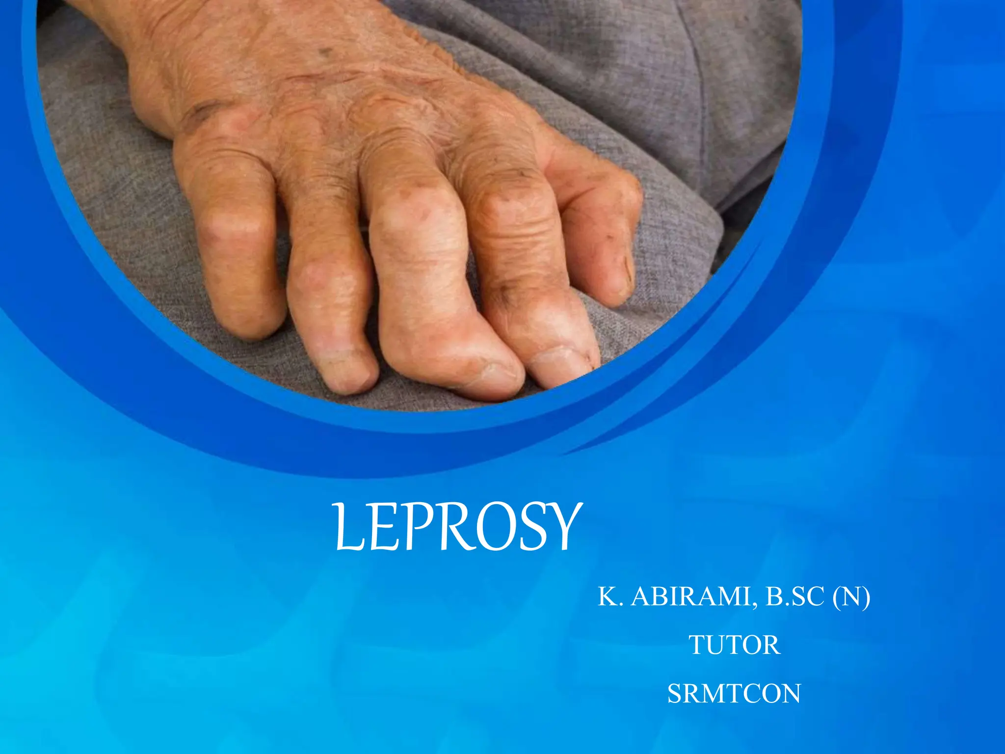 SKIN DISORDERS ADULT HEALTH NURSING-I LEPROSY.pptx