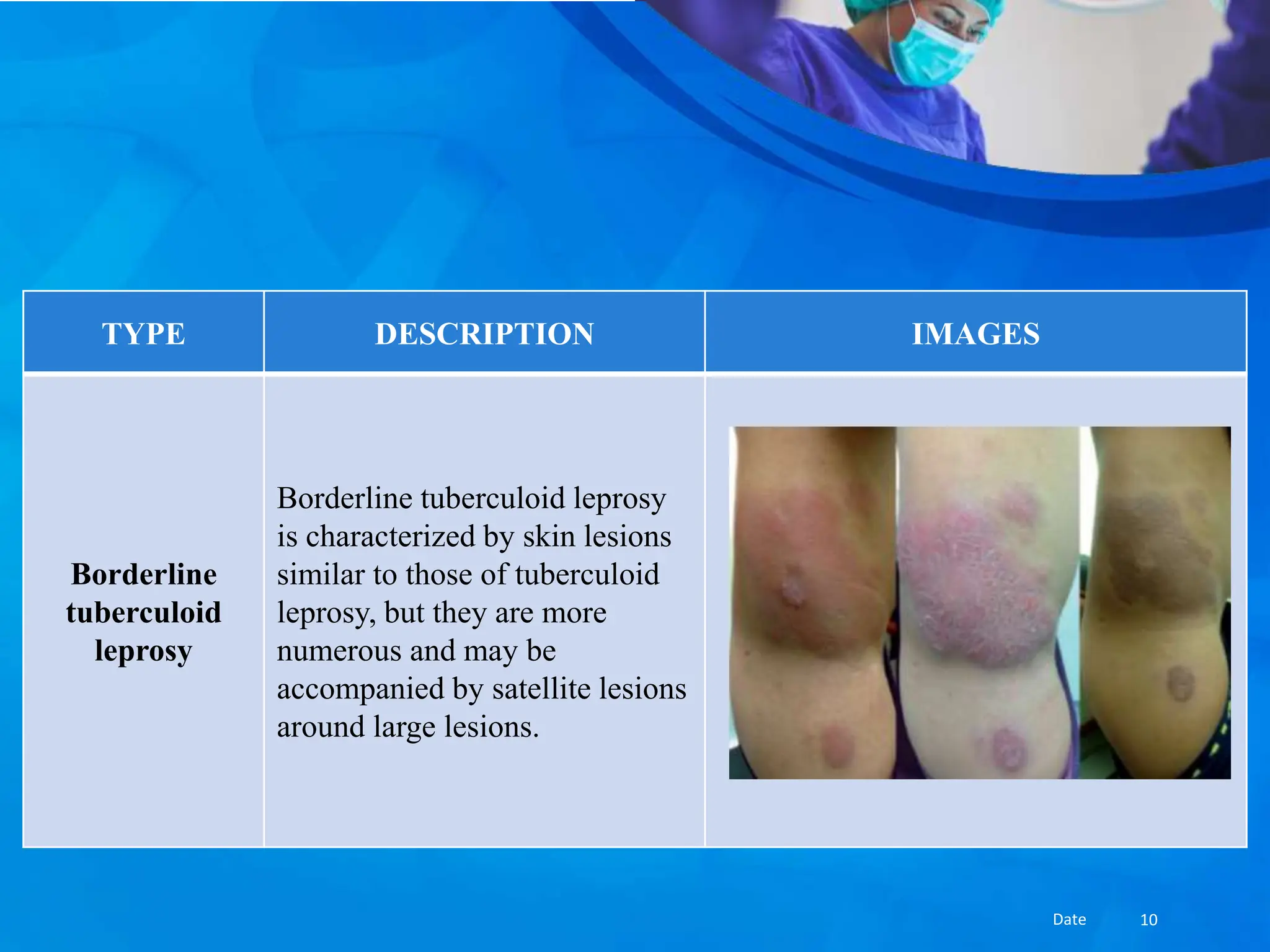 SKIN DISORDERS ADULT HEALTH NURSING-I LEPROSY.pptx