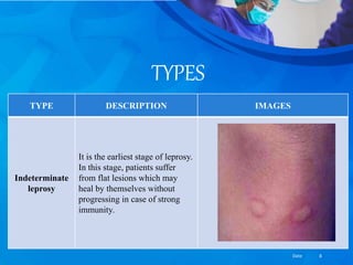 SKIN DISORDERS ADULT HEALTH NURSING-I LEPROSY.pptx