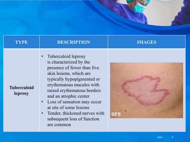 SKIN DISORDERS ADULT HEALTH NURSING-I LEPROSY.pptx