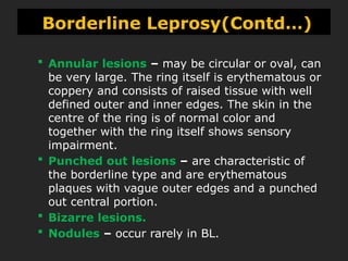 Leprosy, its types, causes, symptoms and treatment | PPTX
