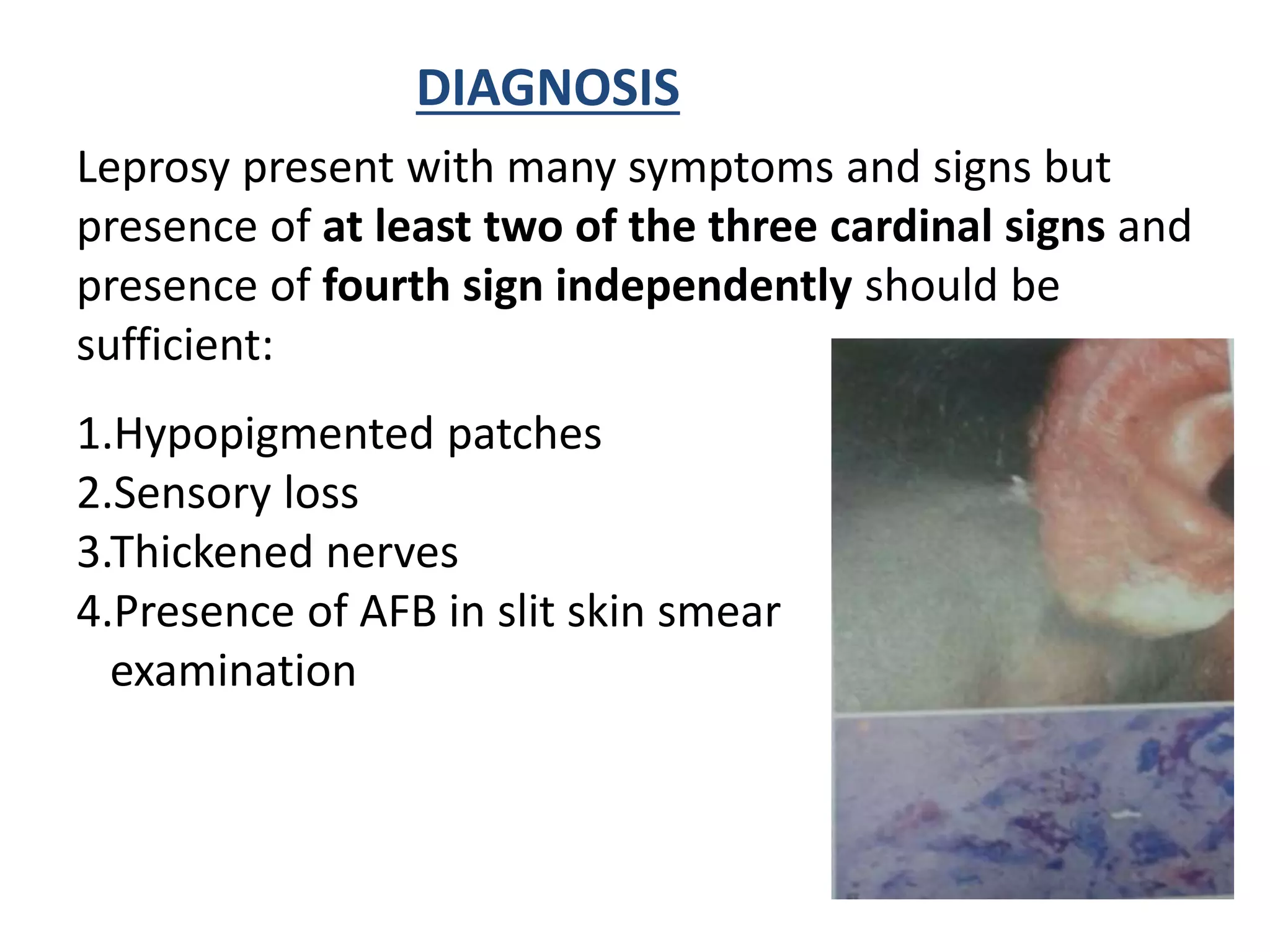 Leprosy - Introduction and Epidemiology | PPTX