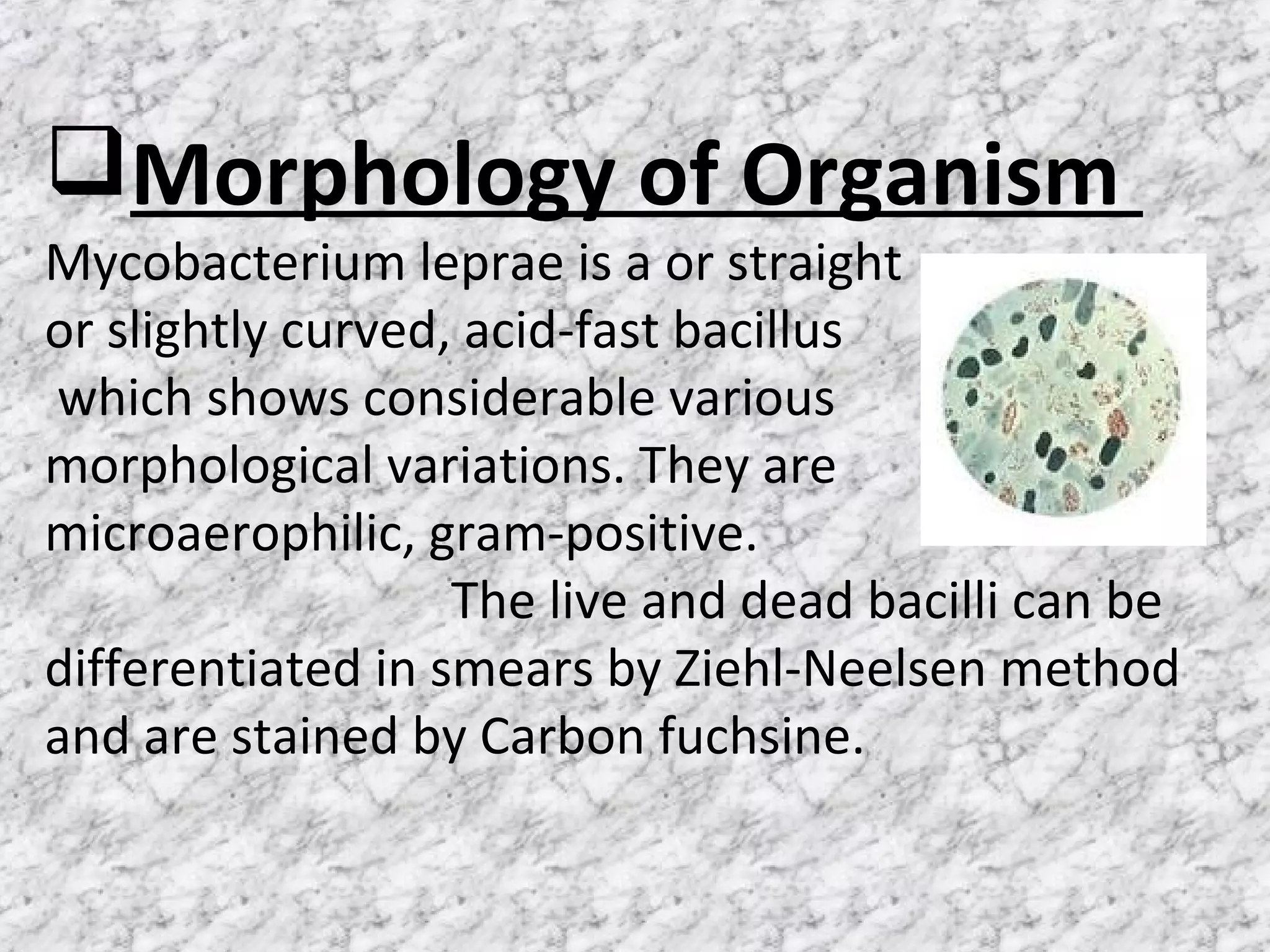 Leprosy | PPT