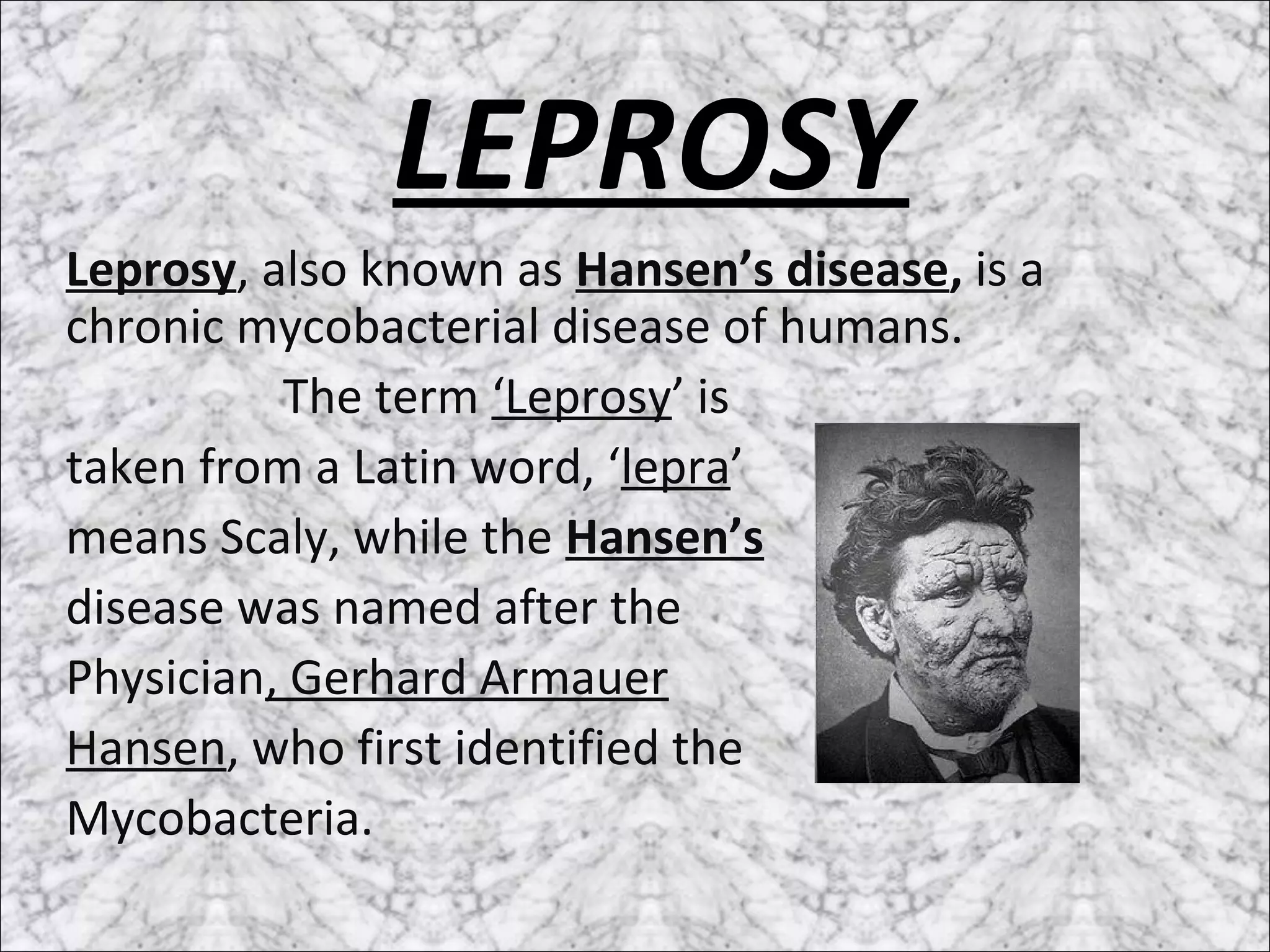 Leprosy | PPT