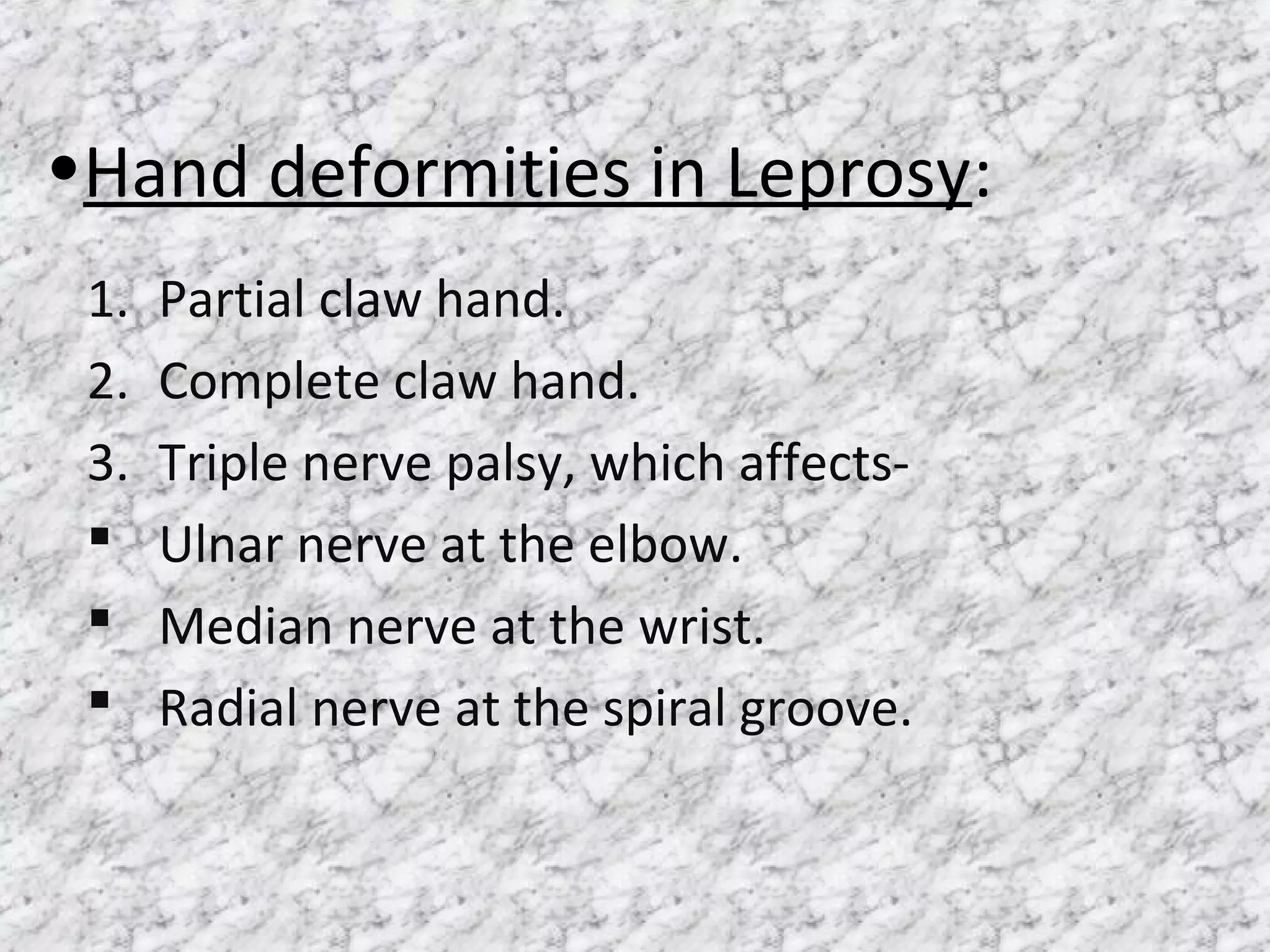 Leprosy | PPT