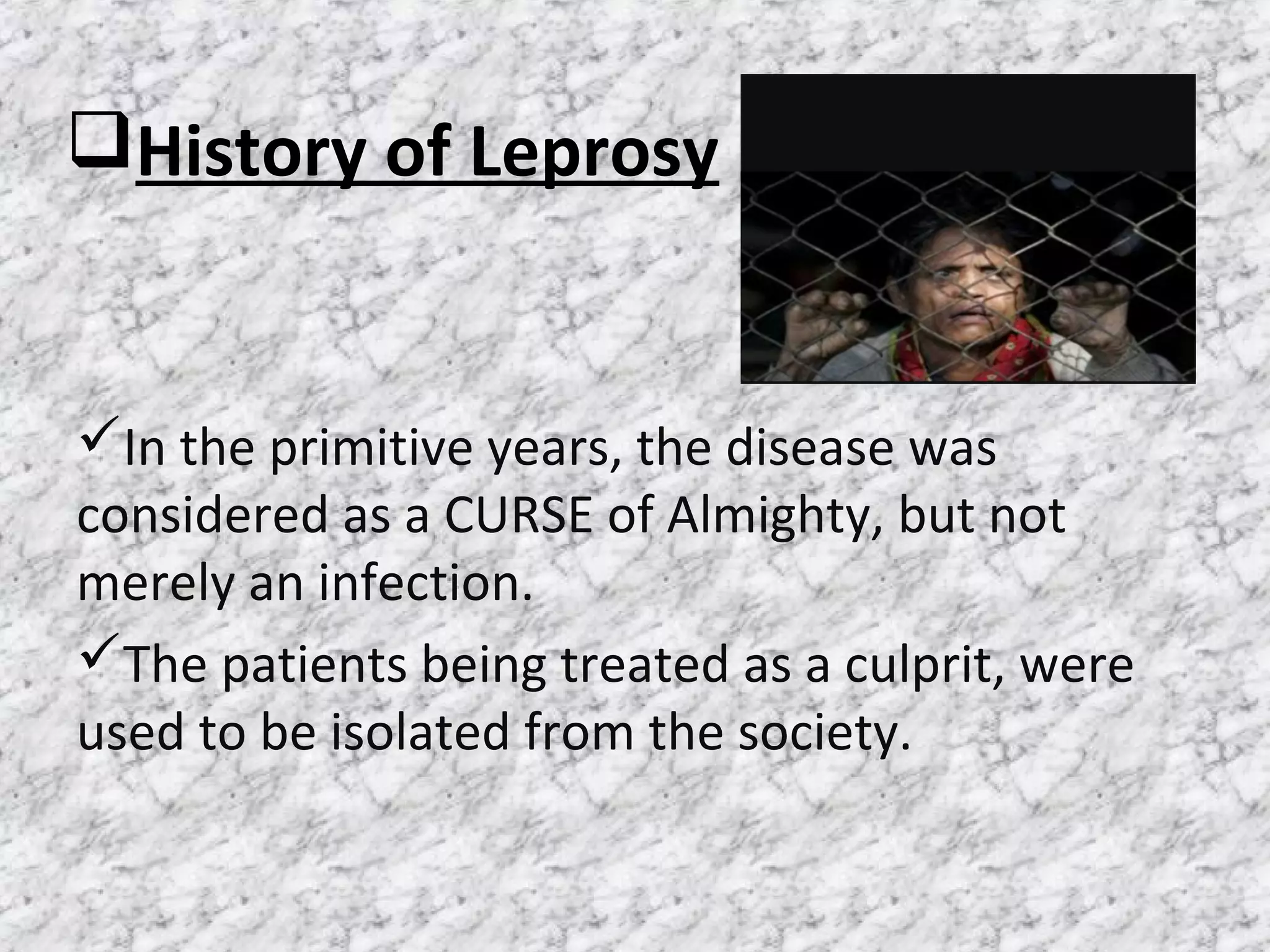Leprosy | PPT