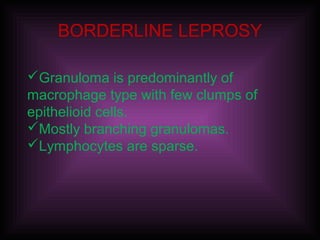 Leprosy (1).ppt hpe | PPT