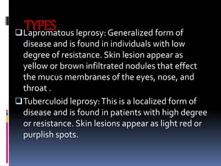 leprosy12345-170608112248.pdf