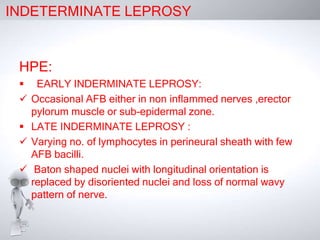 leprosyanditsimmunology-170508165848.pdf