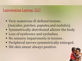 Leprosy and its immunology | PPTX