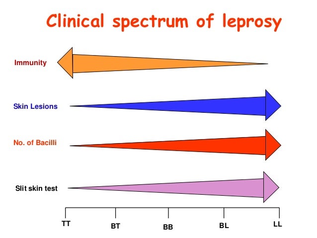 Leprosy and its immunology