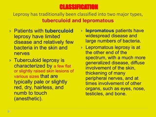 Leprosy -BASICS | PPTX