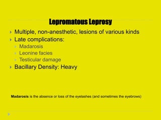 Leprosy -BASICS | PPTX | Infectious Diseases | Diseases and Conditions