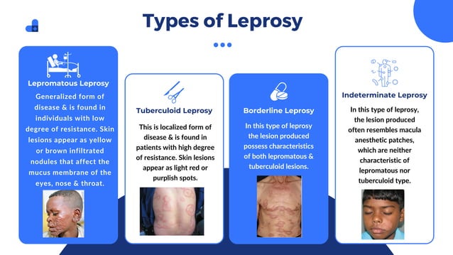 Leprosy Disease PPT (2).pdf topic about the leprosy disease | PDF ...
