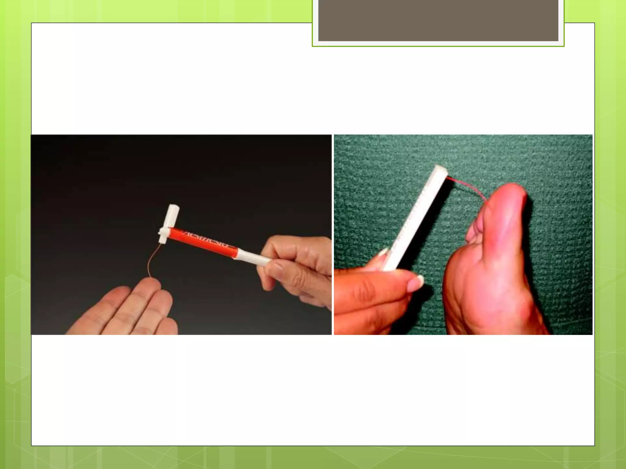 Leprosy - case definition and examination | PPTX