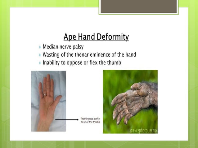 Leprosy - case definition and examination