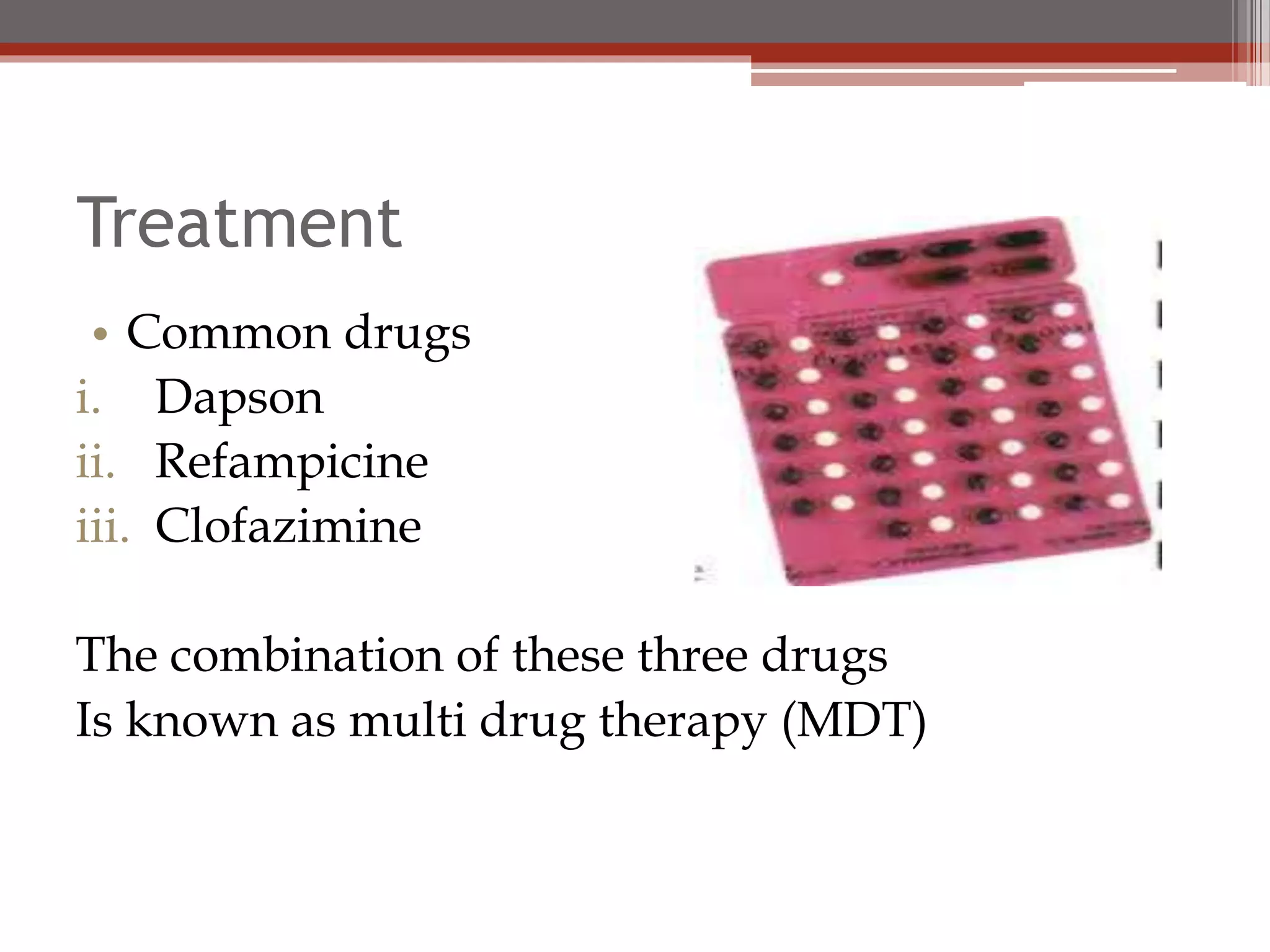 Leprosy ( hansen’s disease ) | PPTX