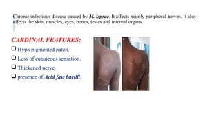 (HANSEN’S DISEASE) Leprosy and Elimination | PPT