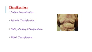 (HANSEN’S DISEASE) Leprosy and Elimination | PPT