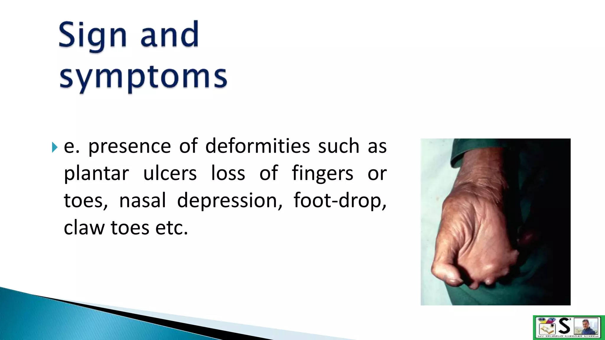 Leprosy in english | PPTX