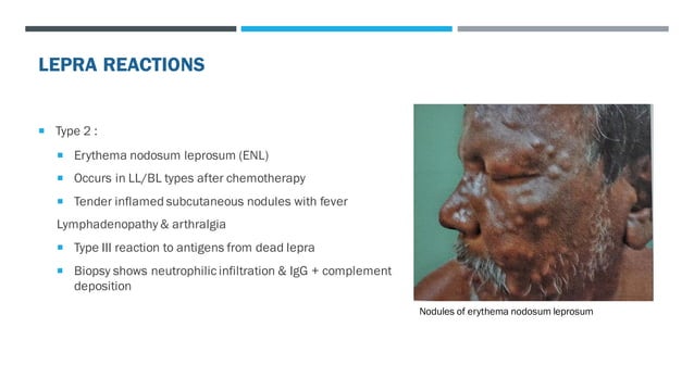 Leprosy in india current scenario 1 (1).pdf