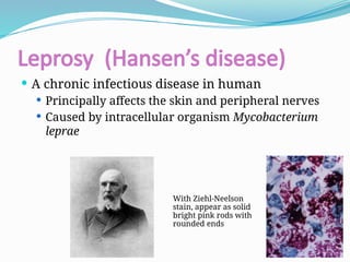 Leprosy Lakar updated.pptx.............. | PPTX