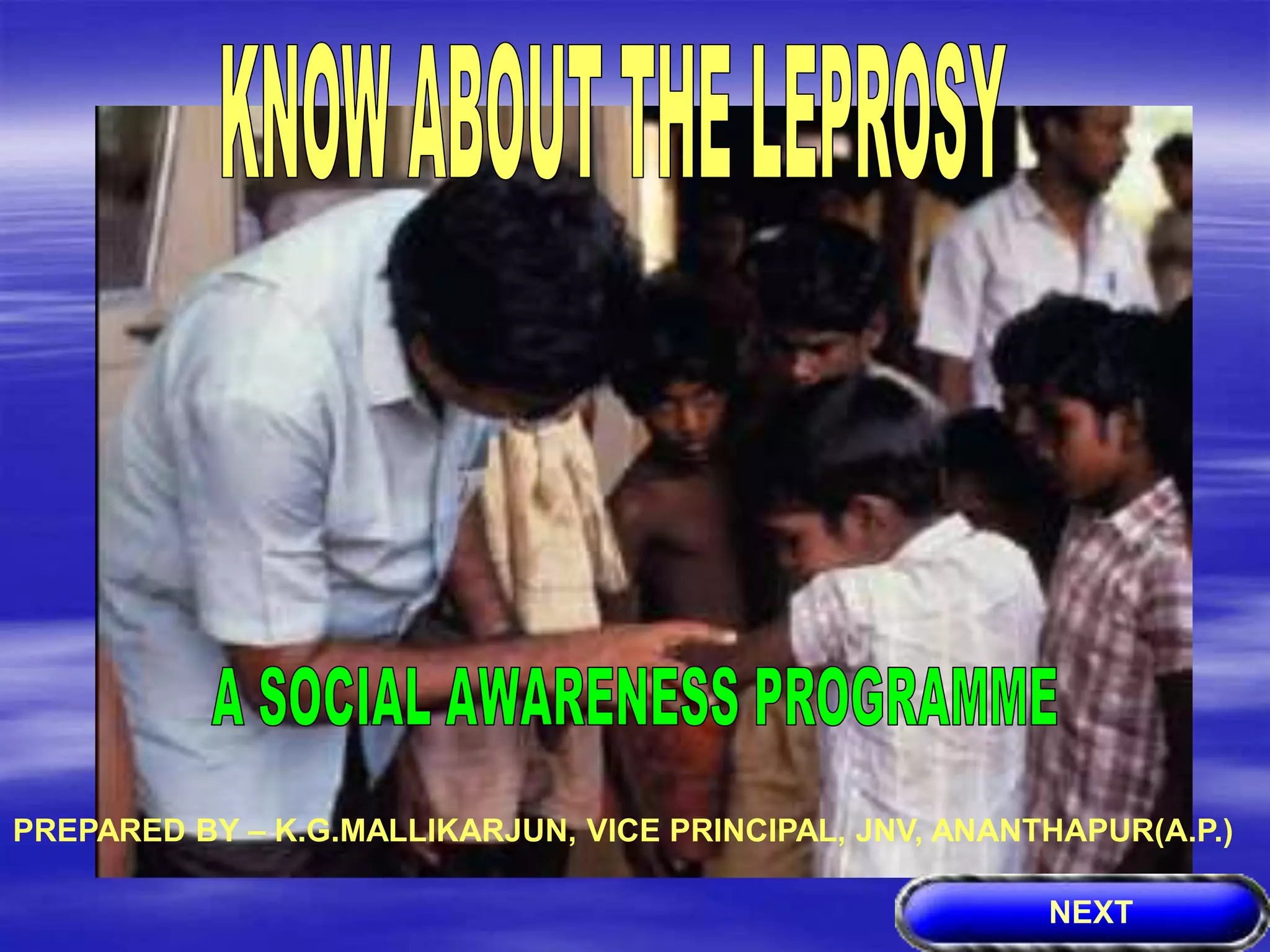 Leprosy presentation1 | PPSX