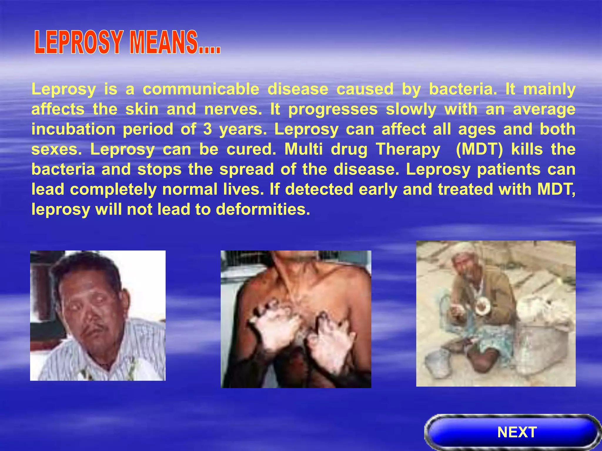 Leprosy presentation1 | PPSX