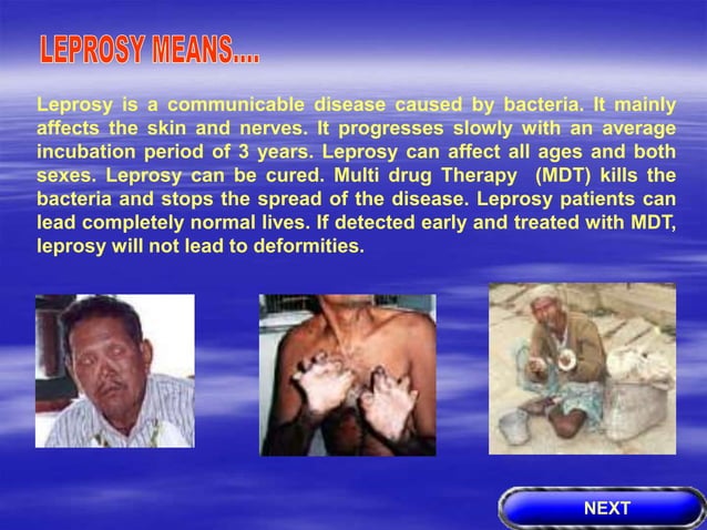 Leprosy presentation1 | PPSX