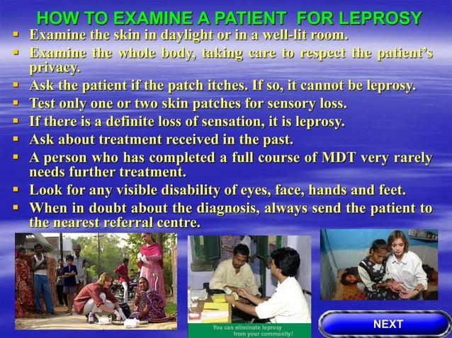 Leprosy presentation1 | PPSX