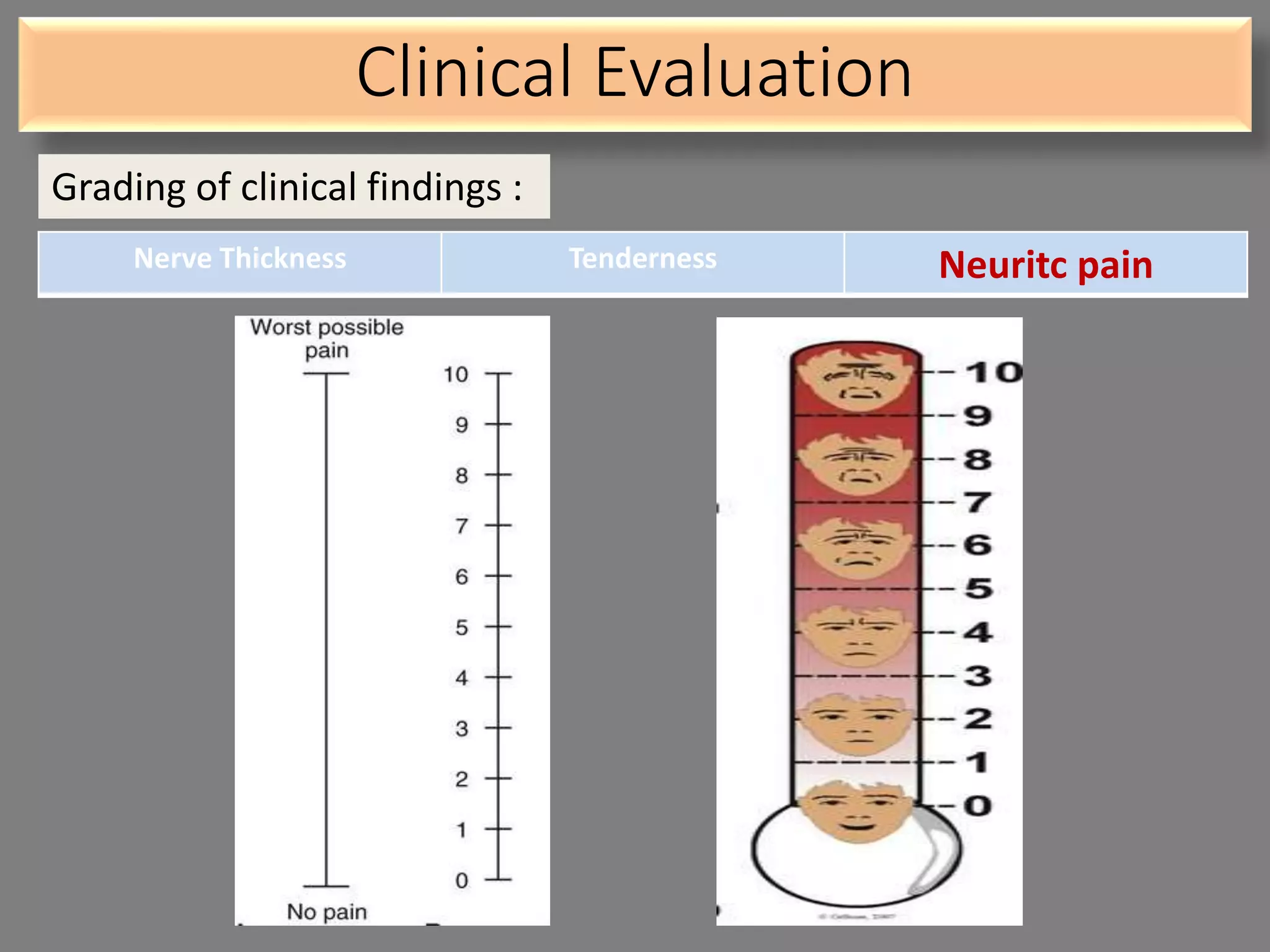 Management of leprosy neuropathy | PPTX