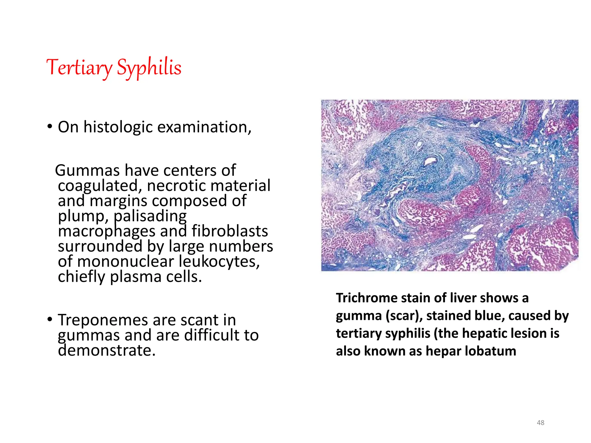 leprosysyphilis - LEPROSY & SYPHILIS.pptx