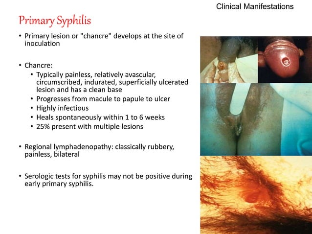 leprosysyphilis - LEPROSY & SYPHILIS.pptx