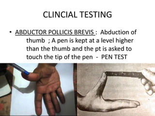 Leprosy tests by aseem | PPTX