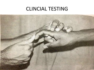 Leprosy tests by aseem | PPTX